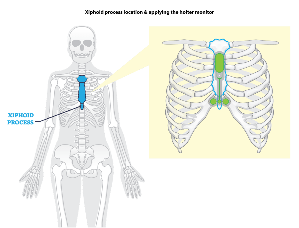 Holter Heart Monitor Troubleshooting and Instructions | The WorkLife Study